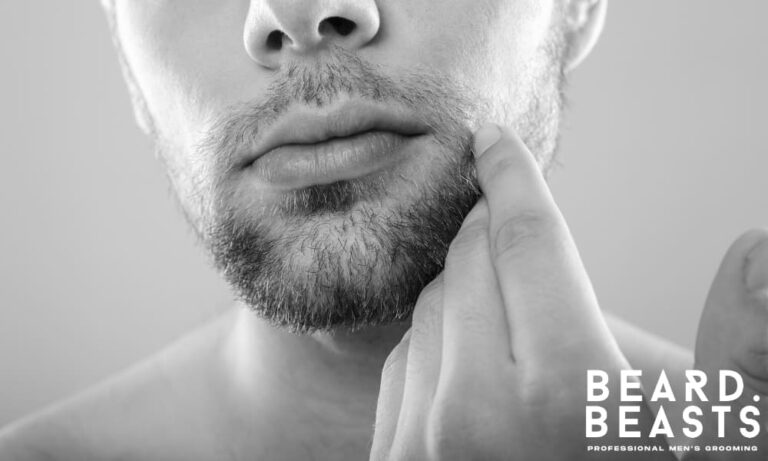 Dry Skin Under Beard? Fix It Fast with These Proven Tips