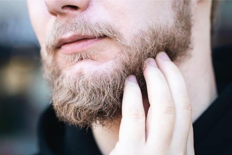 Ingrown Beard Hair: Causes, Home Remedies, and Treatment
